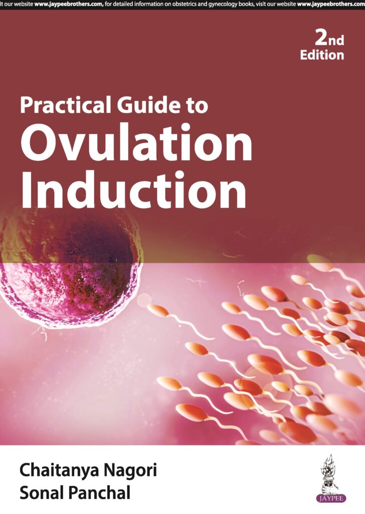 Buy Practical Guide to Ovulation Induction 2nd Edition